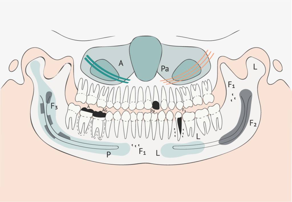 Umweltgifte im Zahn-Kieferbereich | Dr. med. Wilhelm Schüler